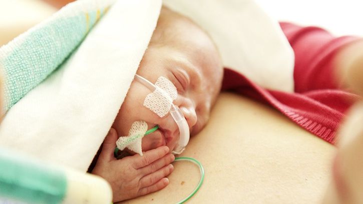 Neonatal Nasogastric Feeding Tube Medela 8 Fr. 42 Inch Pvc Sterile (1/EA)