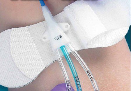 Universal Securement Device Grip-Lok® (1/EA)