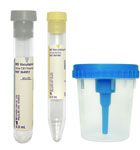 BD Vacutainer Urine Collection Kit with Screw-Cap Cup Part No. 364956 ...